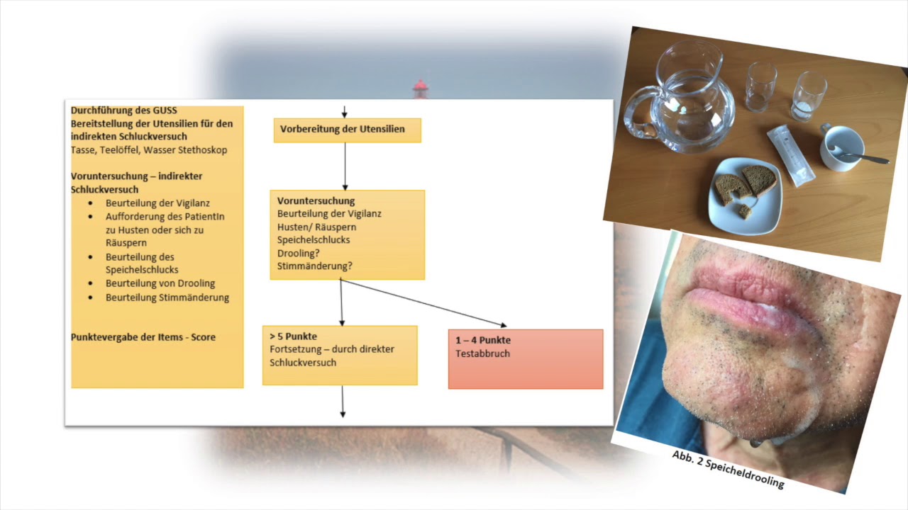 Care Pathway Safety Swallowing - Gugging Swallowing Screen - YouTube