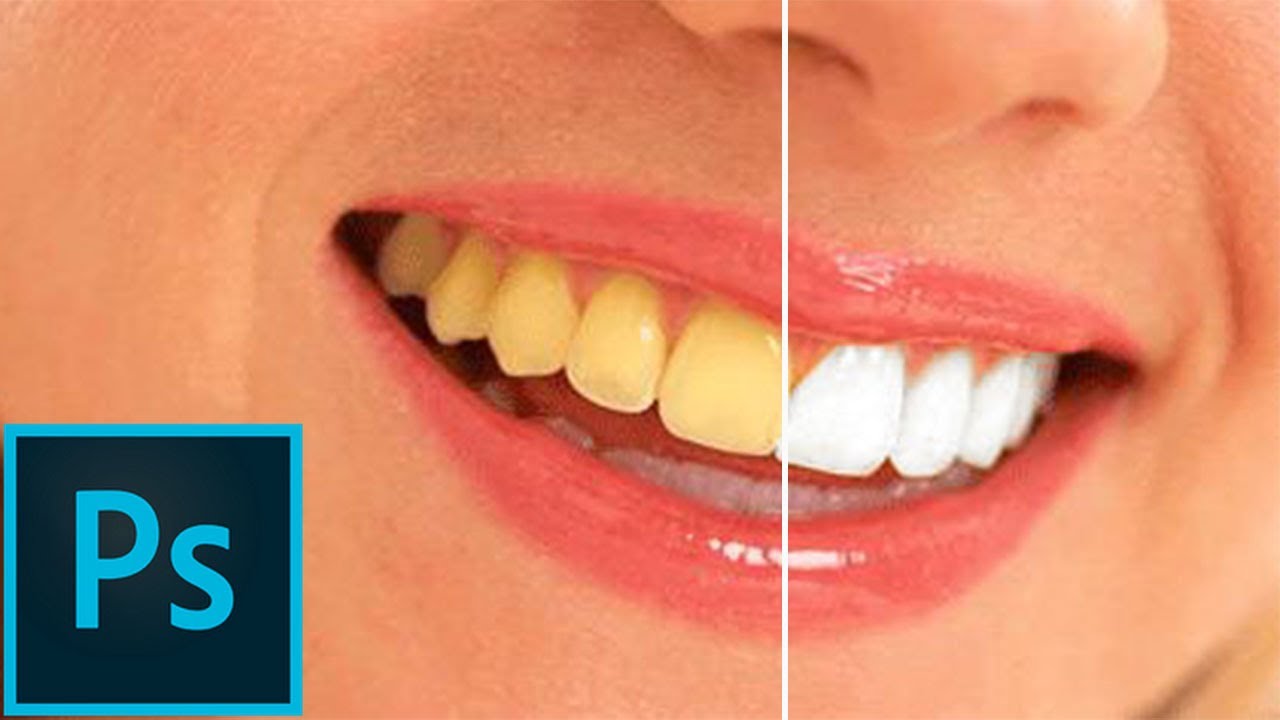 How to easily whiten teeth in photoshop - Teeth whitening |Photoshop ...