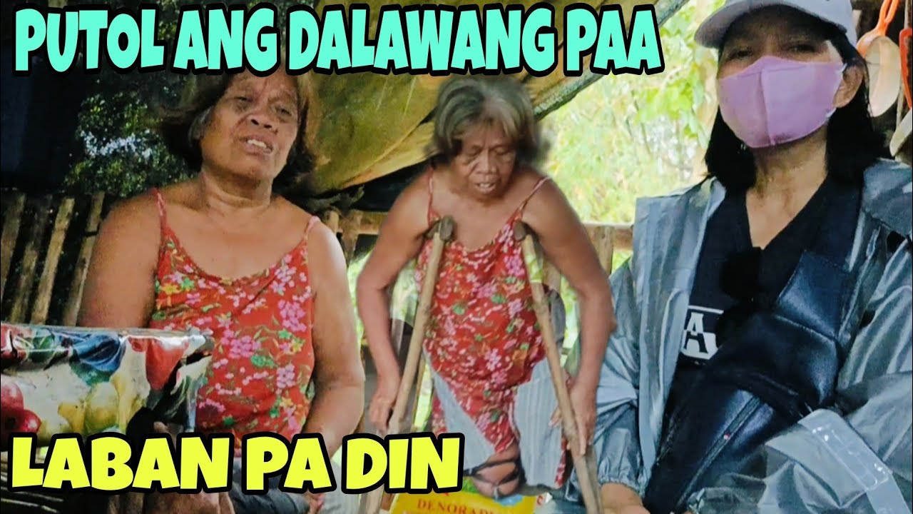 NANAY ZOSIMA, NASAGASAAN NG TREN KAYA PUTOL ANG 2 PAA#ValSantosMatubang ...