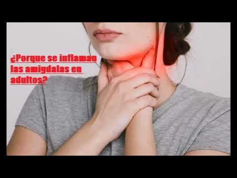 ¿Porque se inflaman las amigdalas en adultos- Salud para la gente de mi ...