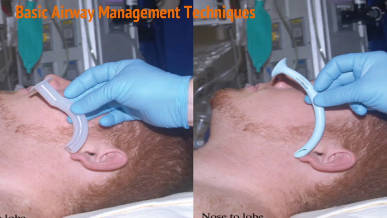Advanced Airway Techniques - YouTube