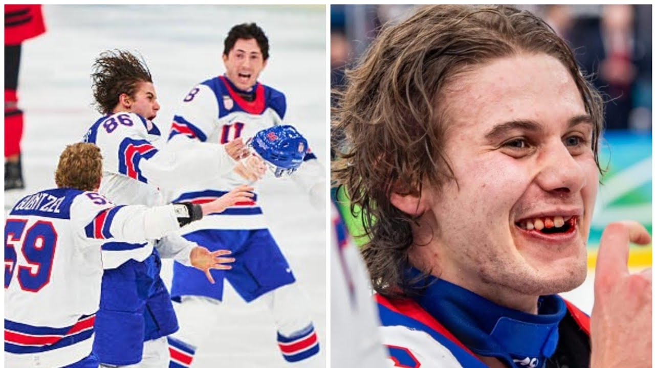 Jack Hughes lost teeth from a high-stick to the mouth before his ...