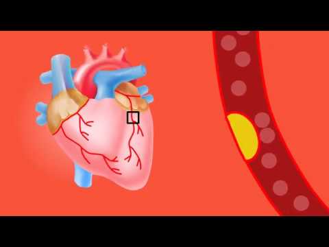 Heart, Heart Attack I No Copyright, Copyright Free, Free for YouTuber I ...