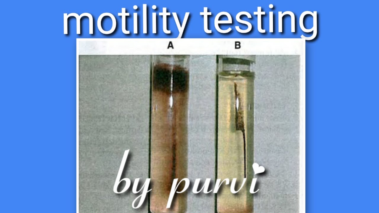 MOTILITY TEST - YouTube
