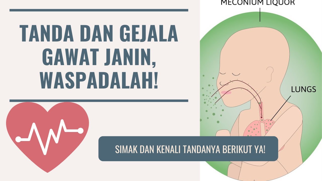 TANDA GEJALA GAWAT JANIN - YouTube
