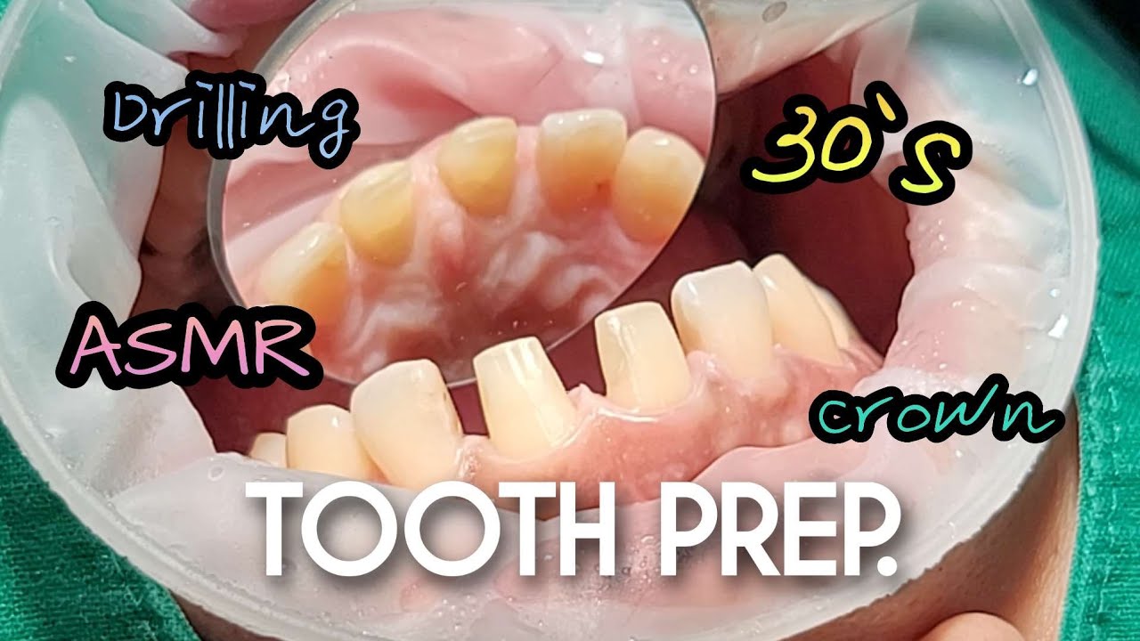 [ASMR] Tooth Preparation #4k #drilling #rootcanal - YouTube