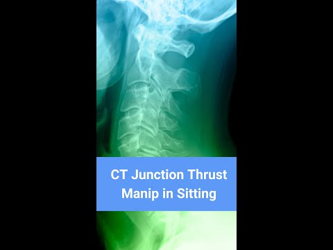 Cervicothoracic Junctional Thrust Manipulation in Sitting - YouTube