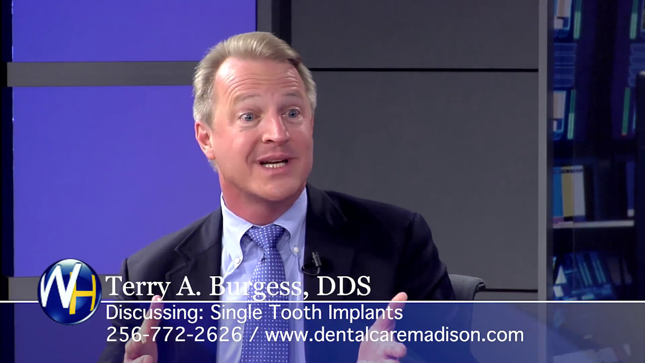 Single Tooth Implants with Dental Implants | Terry Burgess, DDS ...