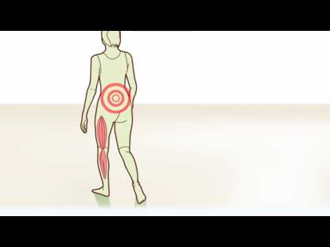 Kengi tedavisi l kalça bıçak saplanma hissi l aksaray fizyoterapist |aksaray gtos terapi