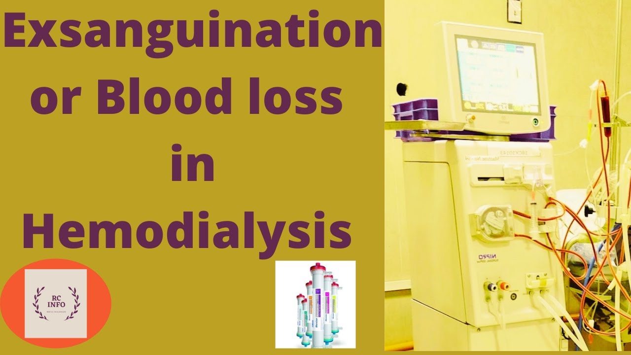 Exsanguination in hemodialysis/Blood loss in dialysis/complications of ...