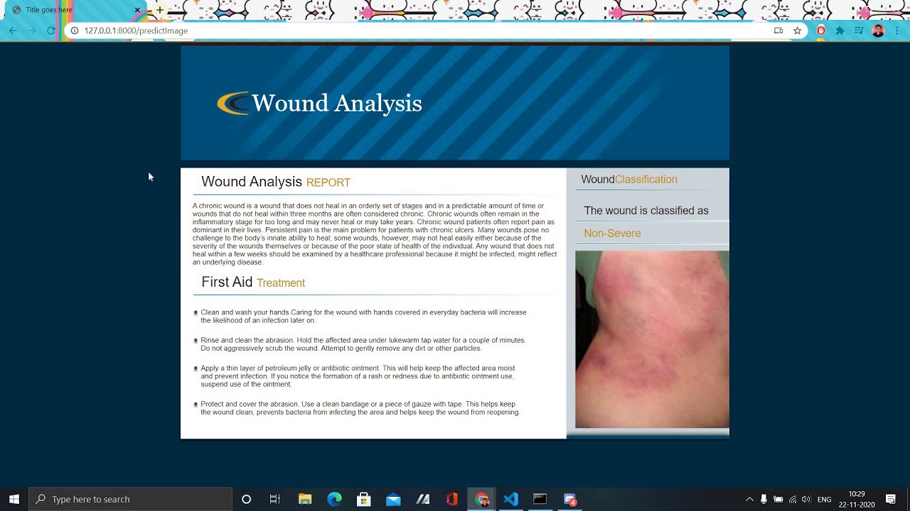 Wound Classification Using Deep Learning - YouTube