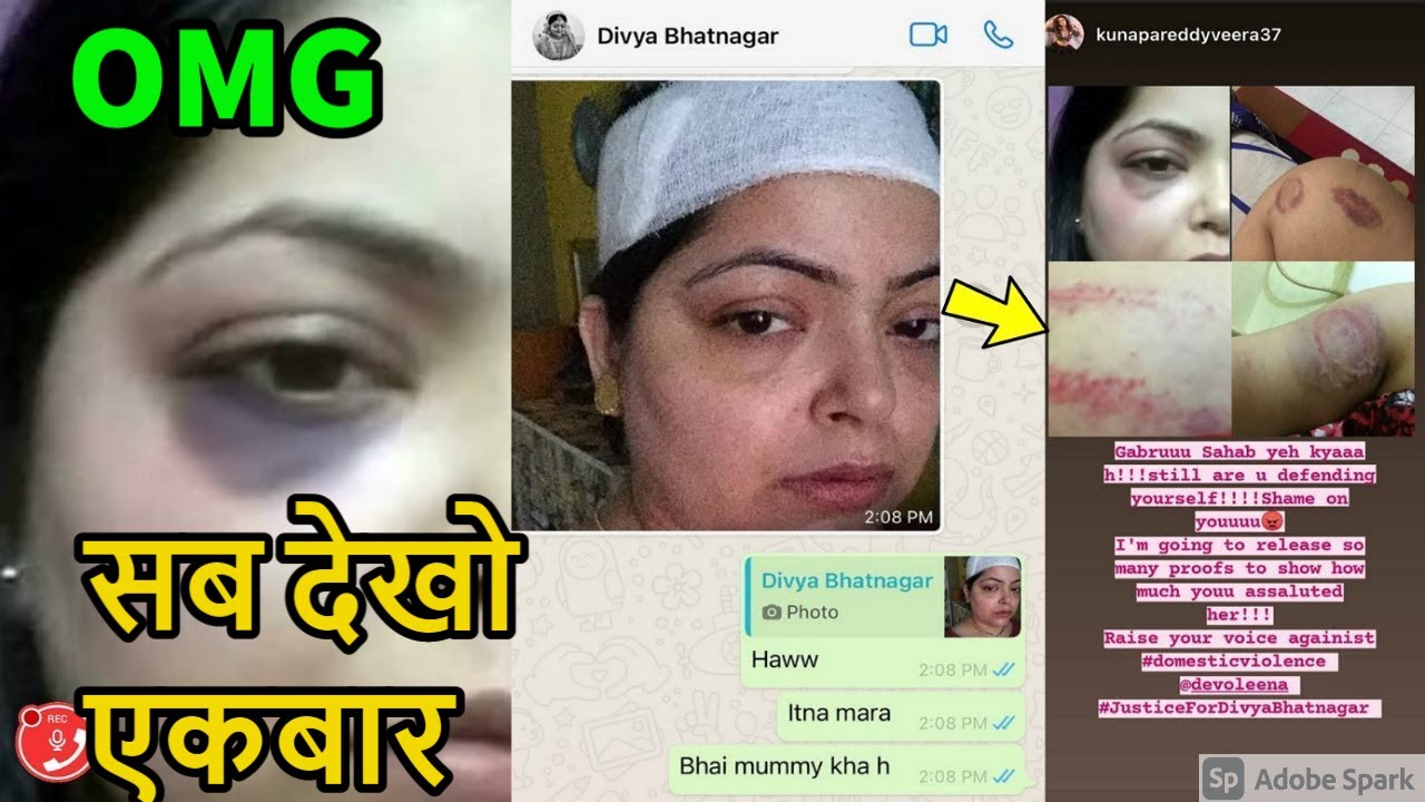 Divya Bhatnagar Audio Call Recording MONSTER Face Of Her Husband Gagan ...