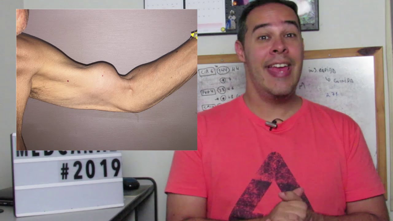 Sinal do Popeye | Medicina e Arte - YouTube