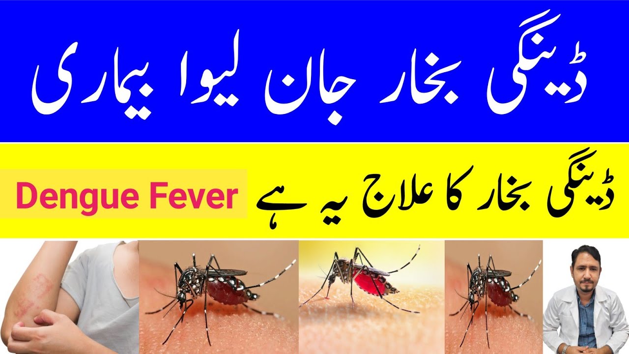 Dengue Fever Symptoms & Treatment Urdu Hindi - Dengue Fever Ka ilaj ...