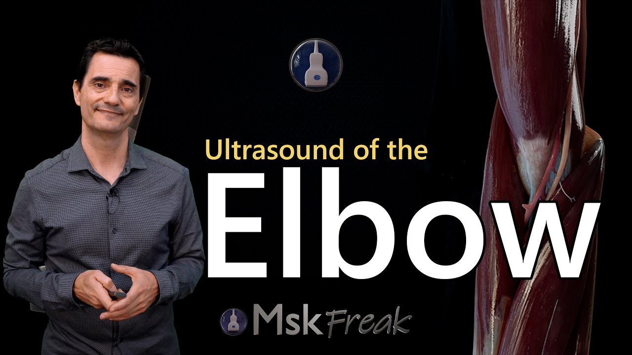 ULTRASOUND OF THE ELBOW ANTERIOR SIDE BONES AND JOINTS - YouTube