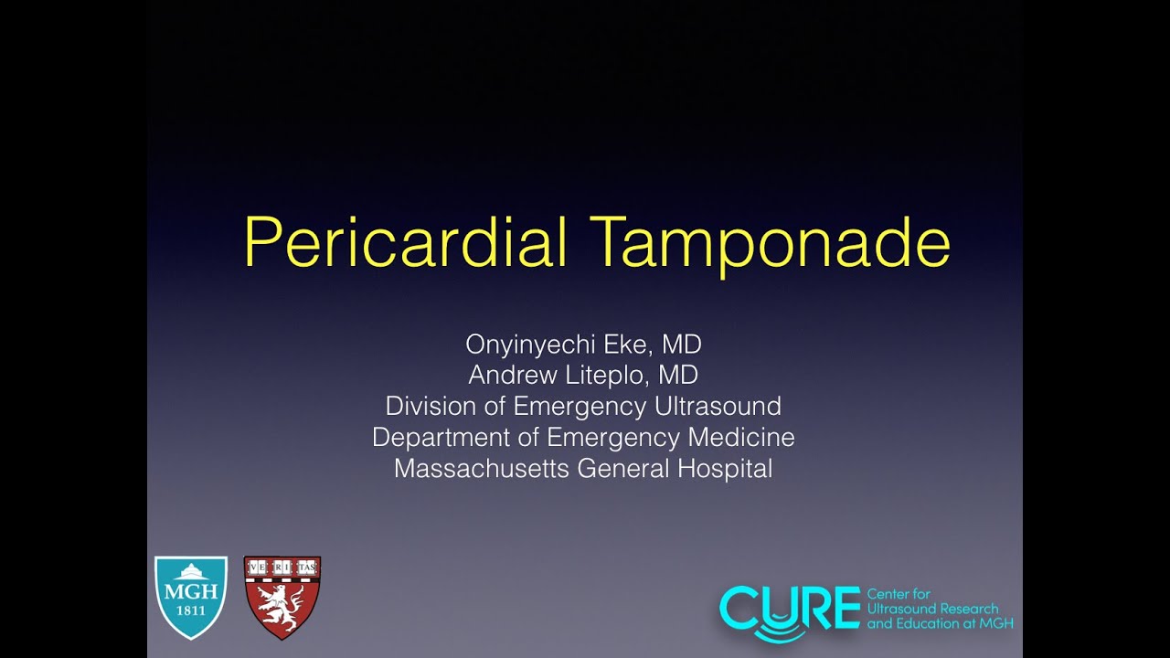 Cardiac Tamponade Procedure