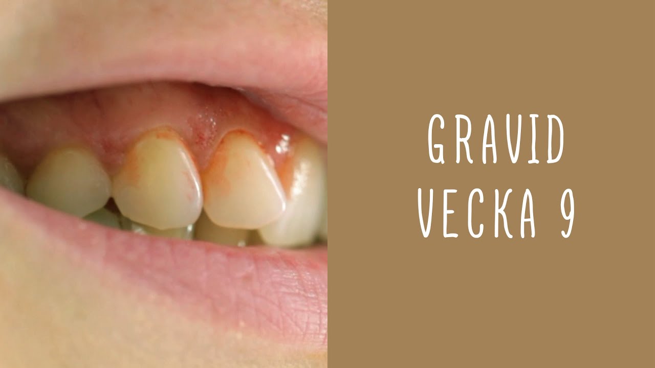 Gravid vecka 9 - YouTube