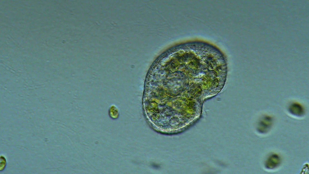 Ciliate: Colpodea - YouTube