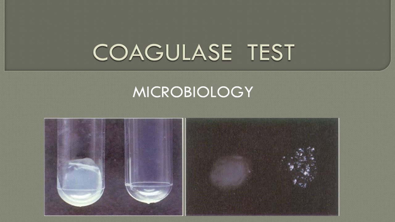 Coagulase Test - Systemic bacteriology - YouTube