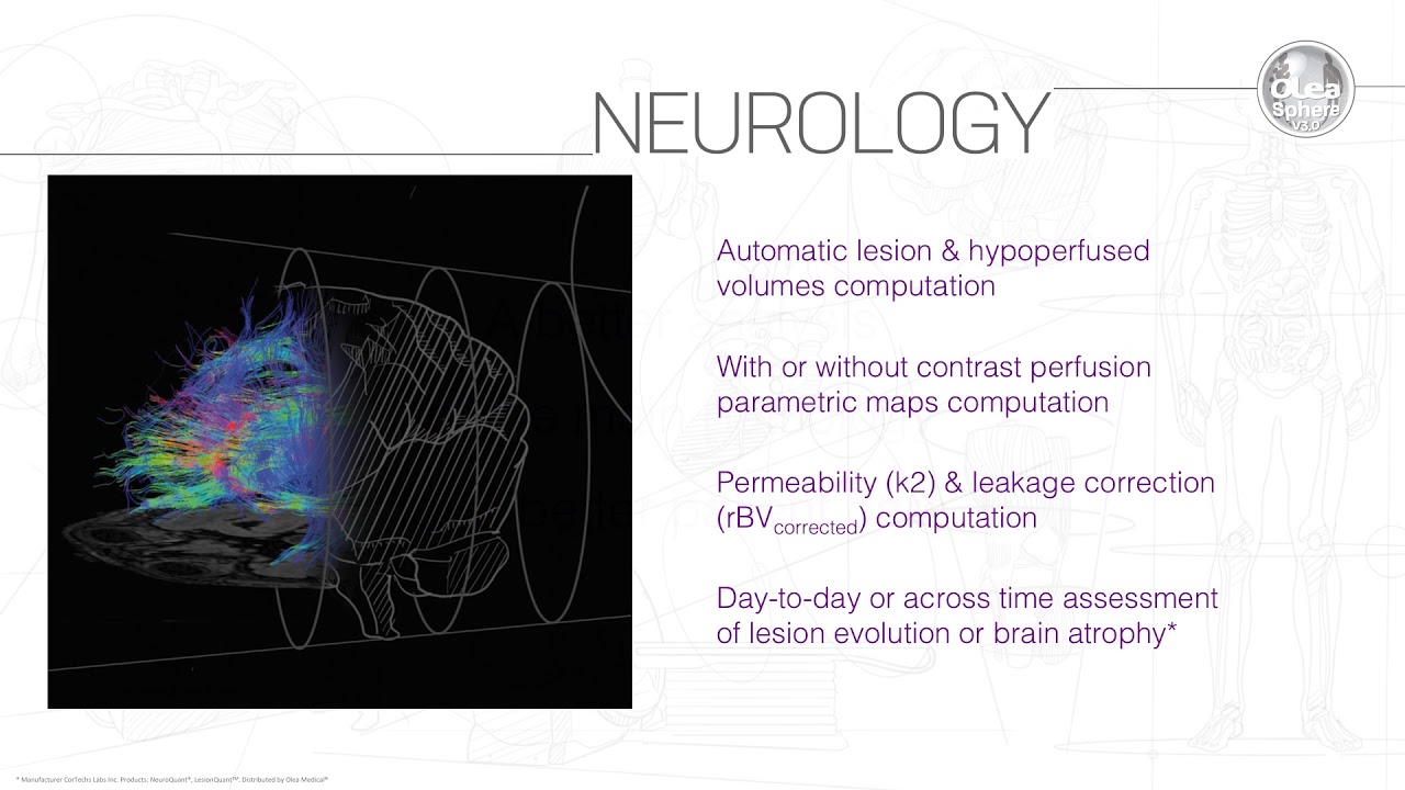 Olea Sphere v3.0 - Neurology Solution - YouTube