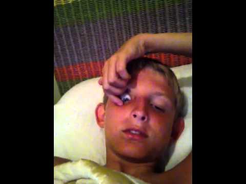 MUST WATCH HOW TO MAKE EYEBALL FALL OUT!!! - YouTube