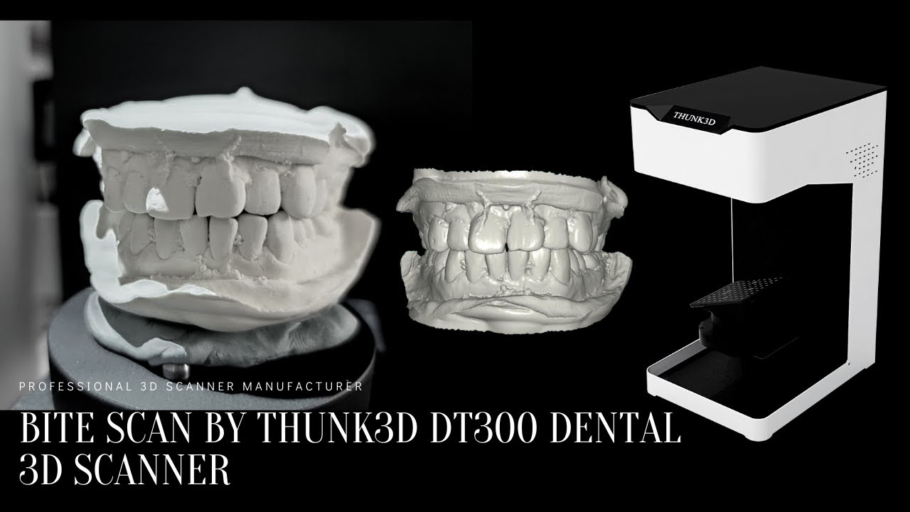 Bite Scan By Thunk3d DT300 dental scanner - YouTube