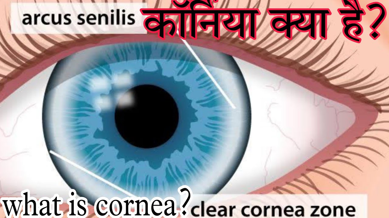 कॉर्निया क्या है ? कॉर्निया किसे कहते हैं ? what is cornea ? what is ...