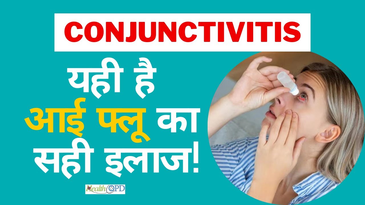 Eye Conjunctivitis: आई फ्लू होने पर क्या करें क्या न करें? जानिए Eye ...