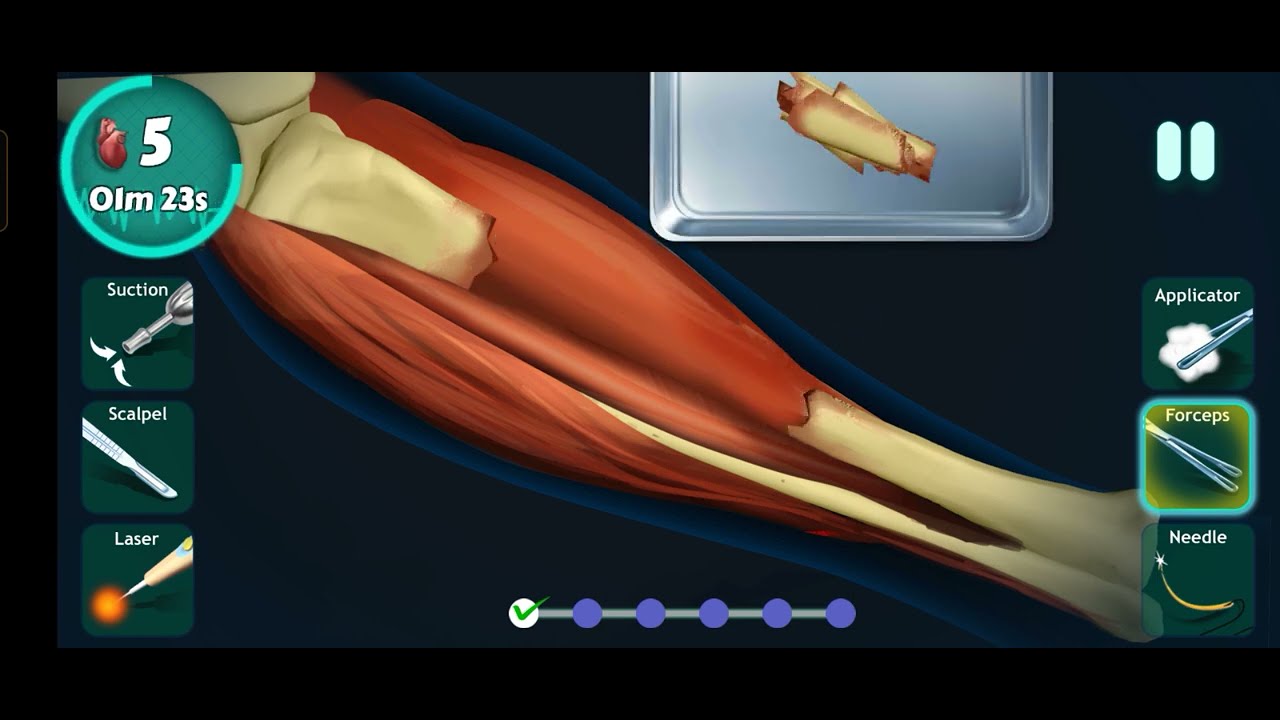 asmr leg treatment animation !! leg treatment cartoon !! leg treatment ...