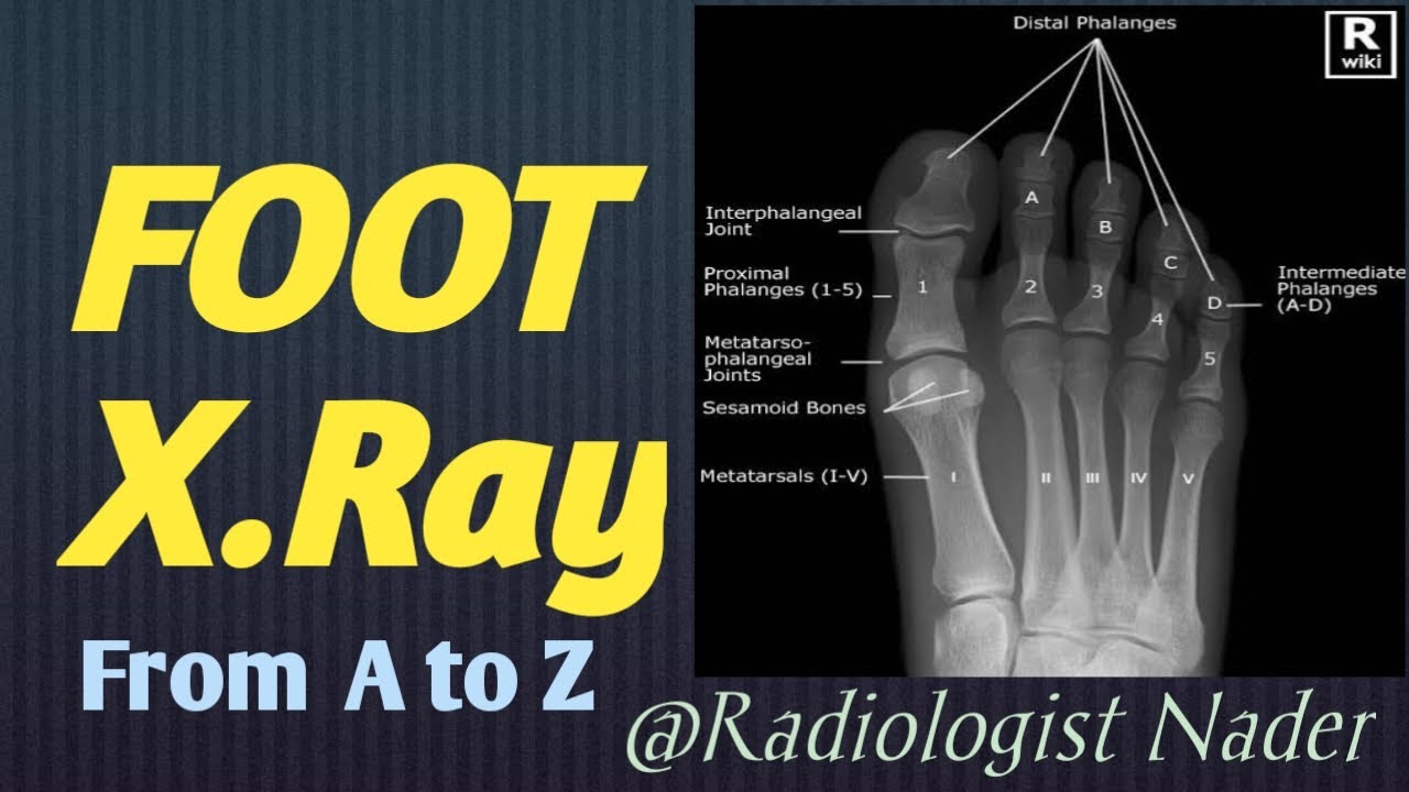 Foot X Ray Positions And foot-x-ray-positions-and