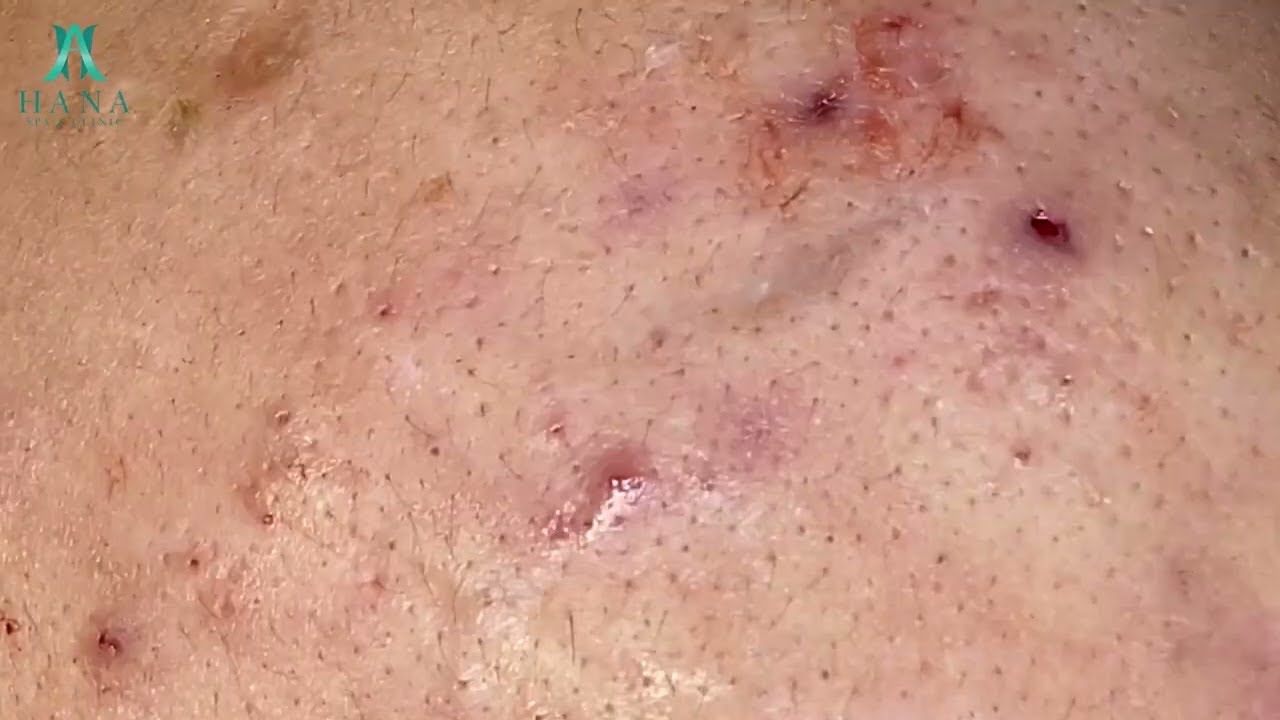 Satisfying Relaxation With Hana Spa #15 - YouTube