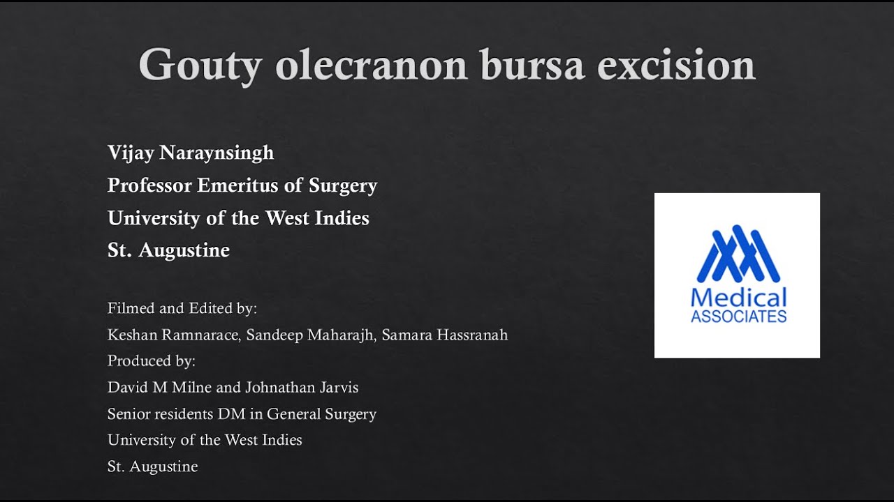Gouty Olecranon Bursa Excision - YouTube