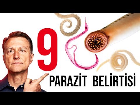 Parazitlerin 9 Uyarı İşareti | Dr.Berg Türkçe