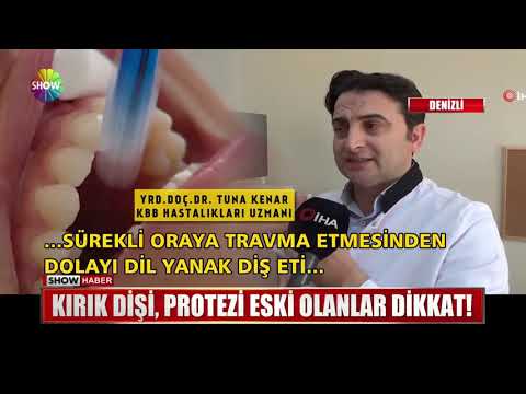 Kırık dişi dilini kesti, kanser oldu!