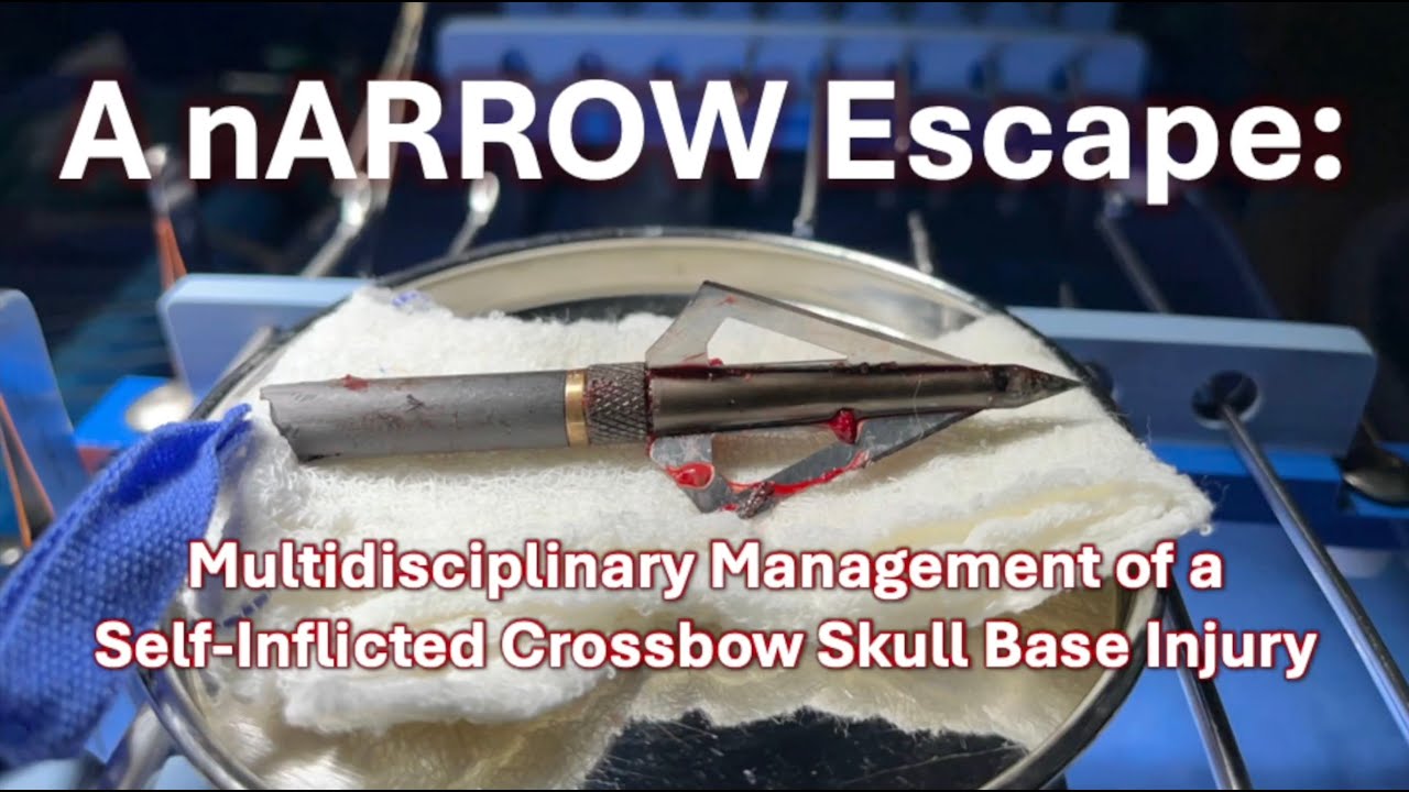A nARROW Escape: endoscopic management of a self-inflicted skull base ...
