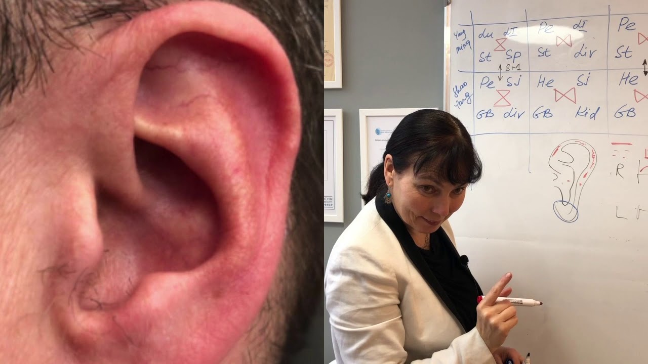 FREE OF CHARGE Online Balance Method. Importance of the Ear & Pulse ...