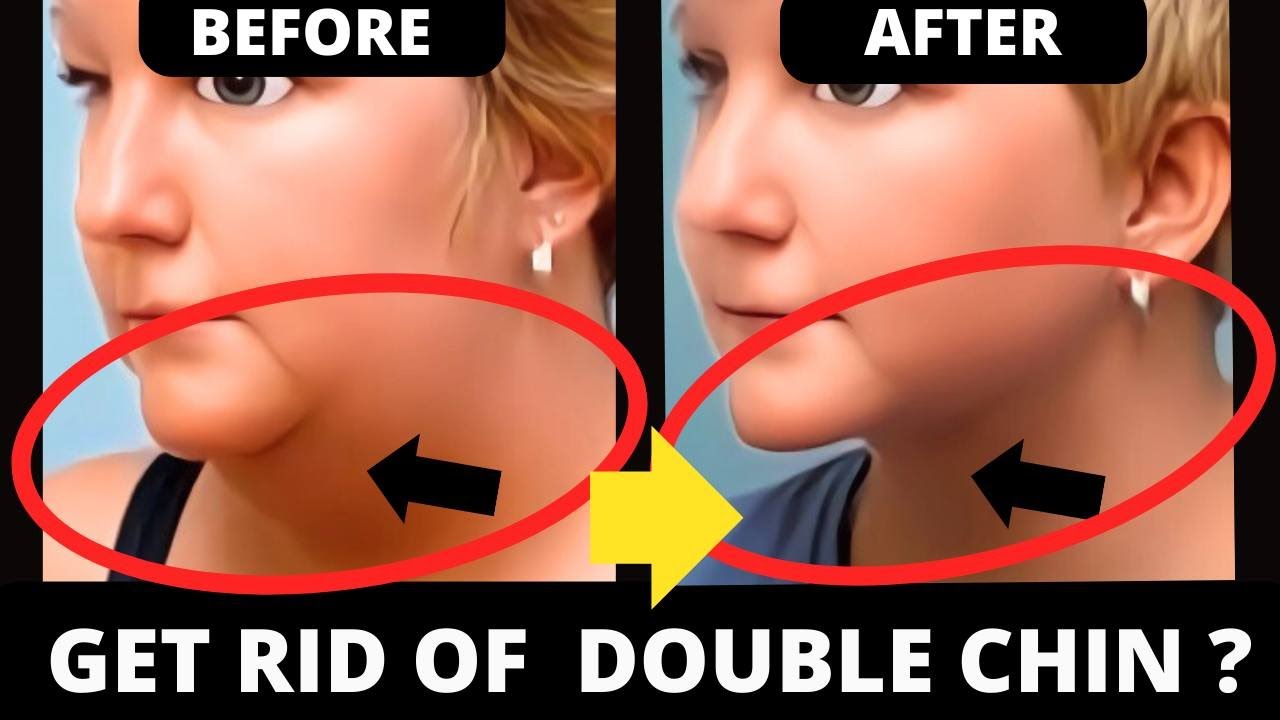 Easy Face Yoga to Melt Double Chin Away – Just 3 Minutes a Day! Tighten ...