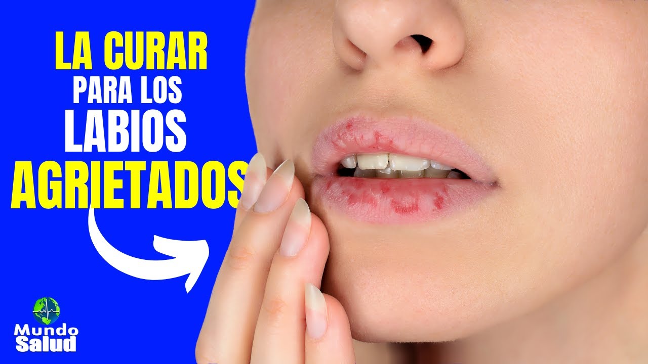 COMO CURAR LOS LABIOS RESECOS Y AGRIETADOS | MUNDO SALUD - YouTube