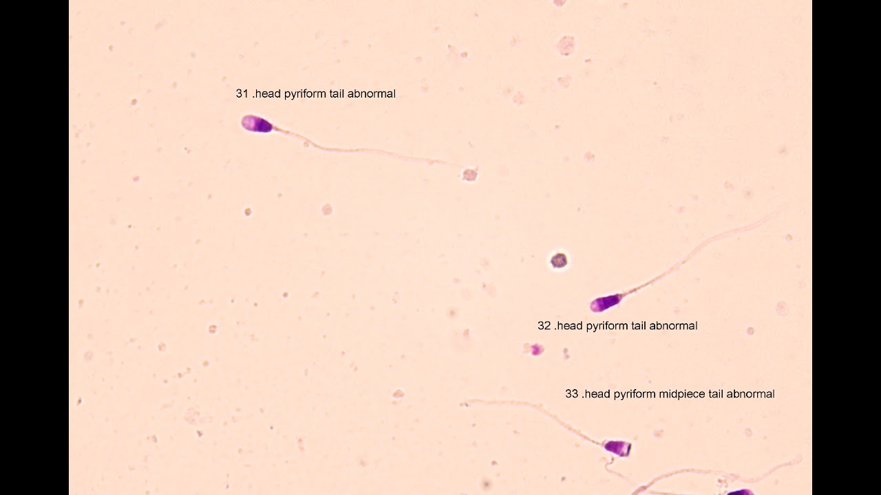 Strict Spermatozoa morphology (Pyriform) - YouTube
