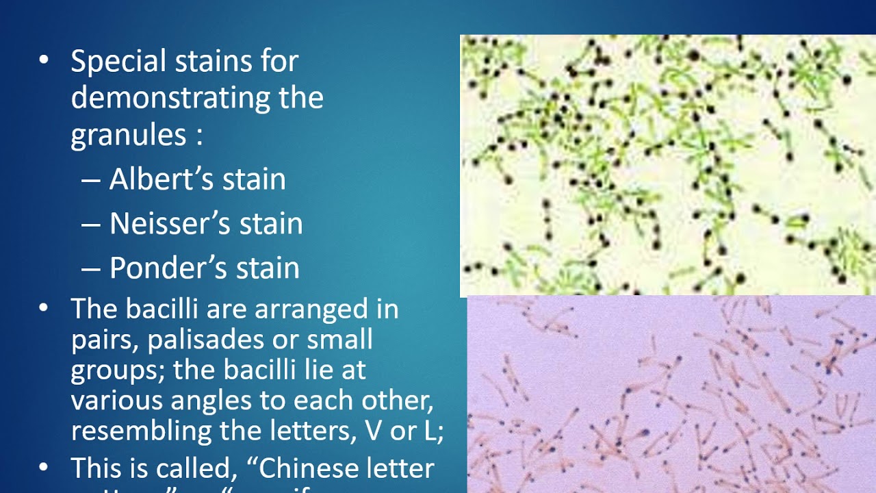 Corynebacterium diptheriaeae MORPHOLOGY CULTURAL CHARACTERISTICS - YouTube