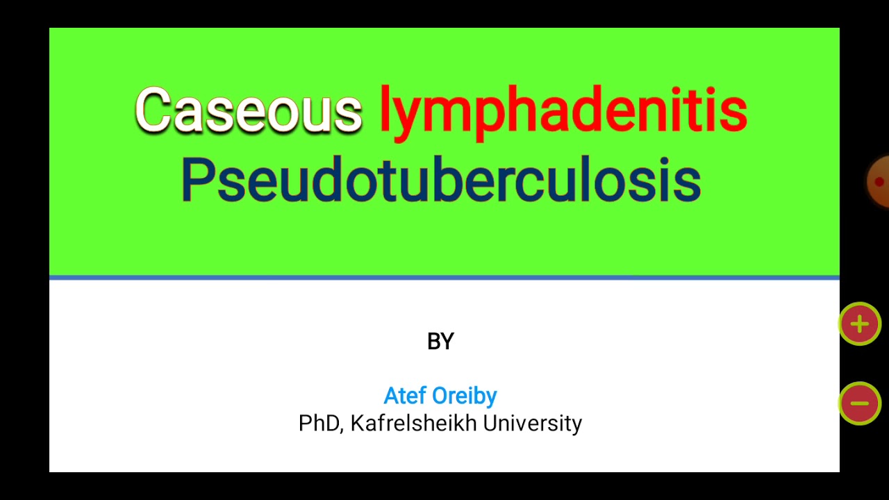 Caseous Lymphadenitis CLA - YouTube