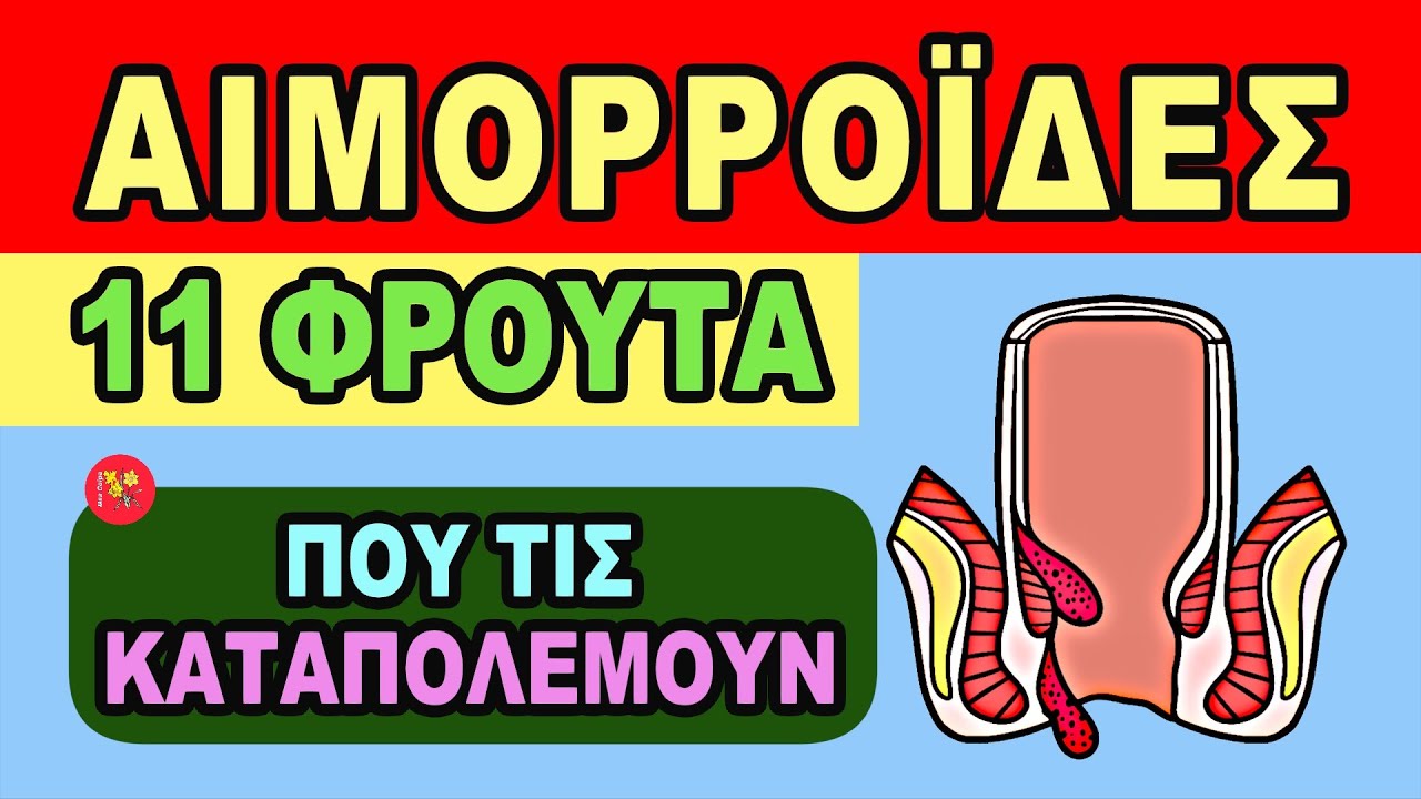 ΑΙΜΟΡΡΟΪΔΕΣ - 11 ΦΡΟΥΤΑ ΓΙΑ ΤΗΝ ΚΑΤΑΠΟΛΕΜΗΣΗ ΤΟΥΣ - YouTube