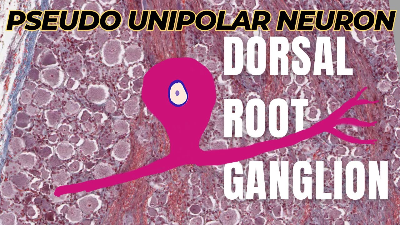 Unipolar Neuron Histology Exam 4 - Anatomy & Physiology 150 with Vinton ...