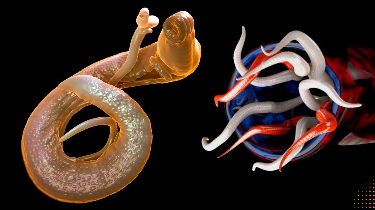 All toxins and parasites will come out of your body! My grandfather's ...