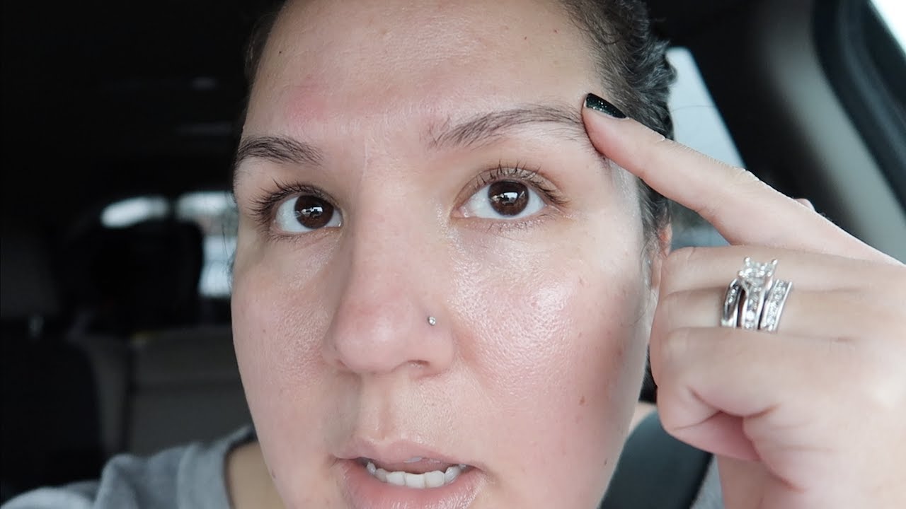 Vlog: *December 15-17, 2020* ~My First Botox Experience!~ - YouTube