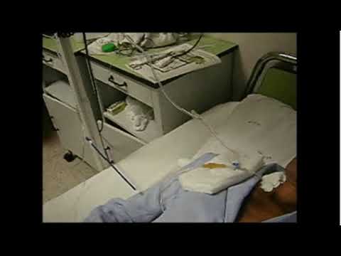 Medición de presión venosa central PVC - YouTube