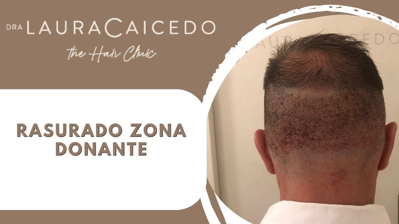 Paciente rasurado zona donante - YouTube