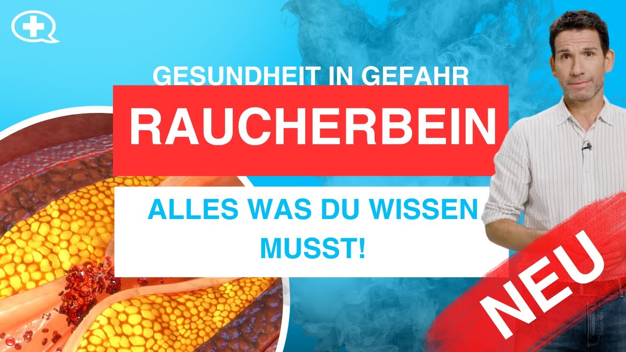 Raucherbein: Was ist das? Und warum können auch Nichtraucher erkranken ...