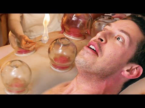 The Try Guys Try FIRE Cupping