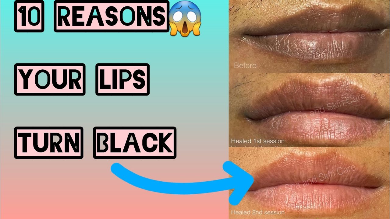 10 reasons why your lips turn black||आपके होंठ काले होने के 10 कारण # ...